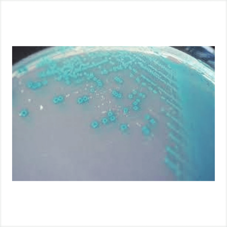 MUELLER KAUFFMANN BROTH BASE W/BRILLIANT GREEN & NOVOBIOCIN (MKTTN) - CMLAB