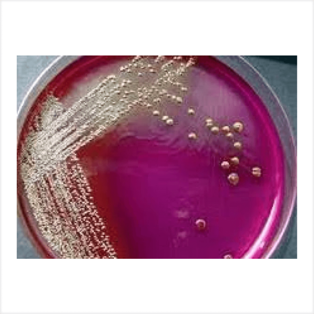 MUELLER KAUFFMANN BROTH BASE W/BRILLIANT GREEN & NOVOBIOCIN (MKTTN) - CMLAB